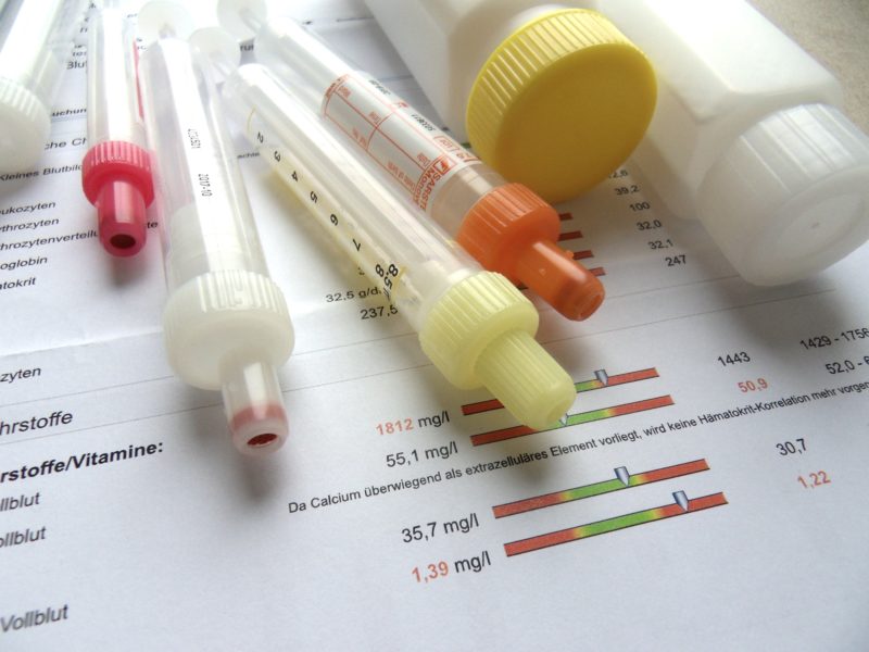 Durch Labordiagnostik die Ursachen von Krankheiten finden | MEDICAL ... Durch Labordiagnostik die Ursachen von Krankheiten finden | MEDICAL ...
